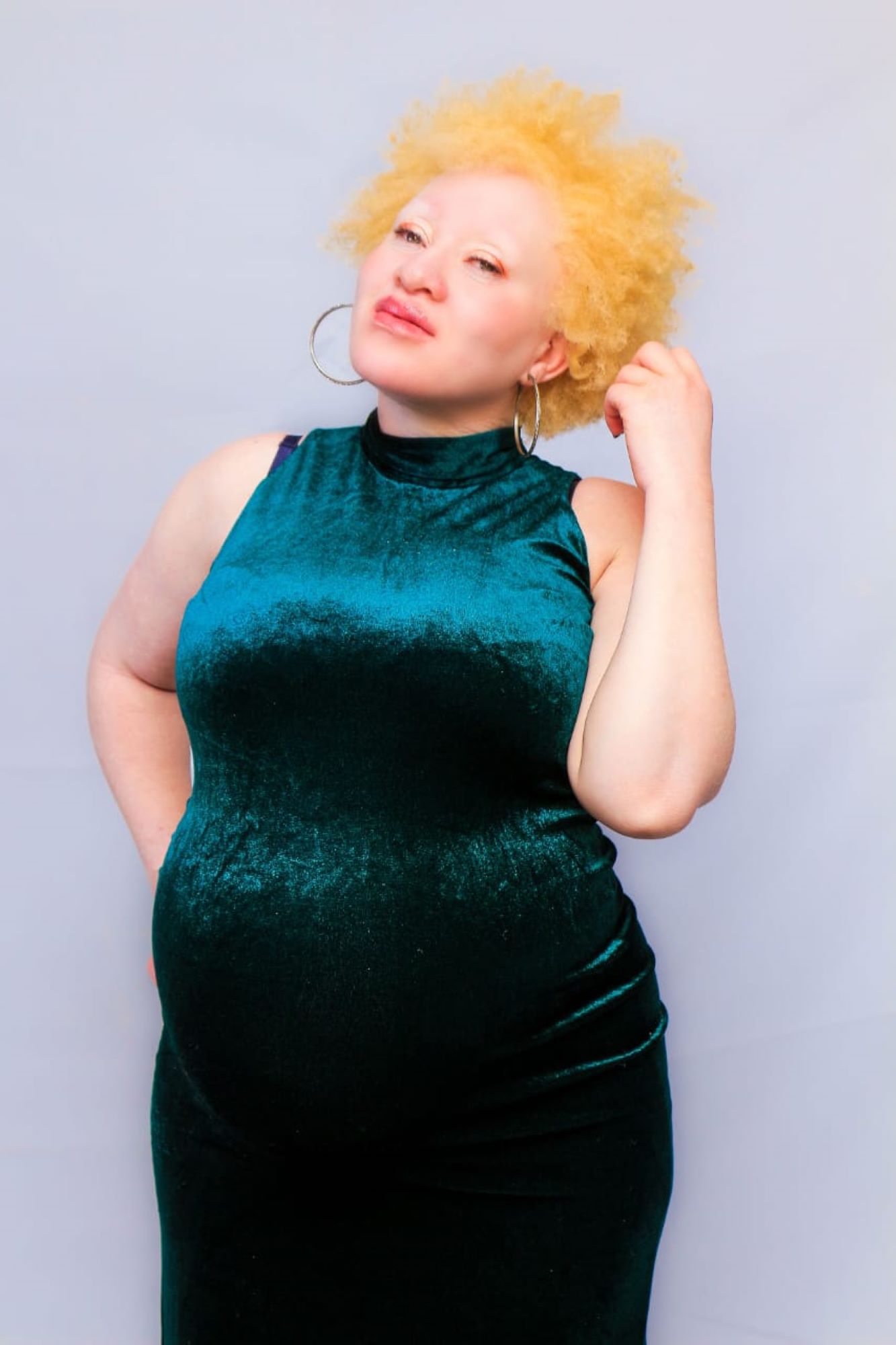 Albino actress overcomes abuse, champions rights for albinism